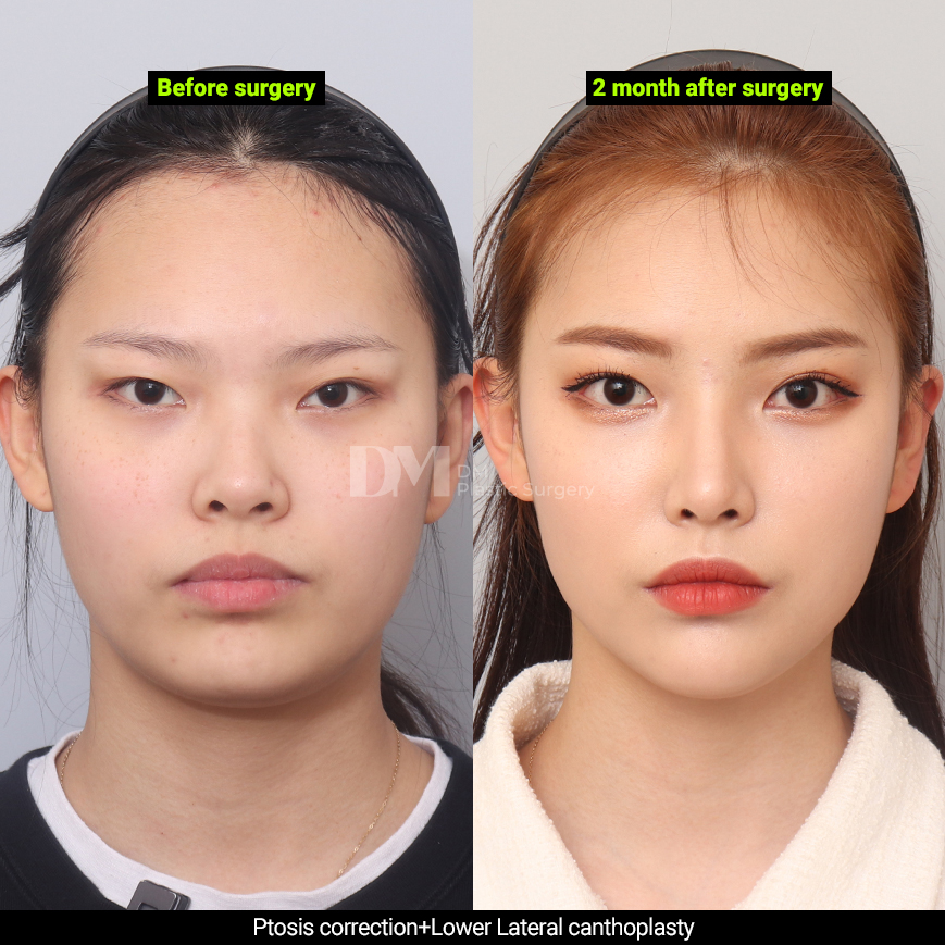 DM Plastic Surgery