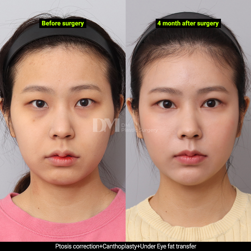 DM Plastic Surgery