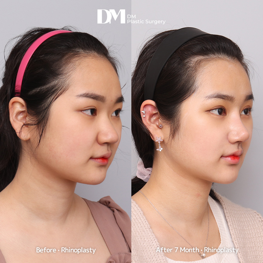 DM Cosmetic Surgery