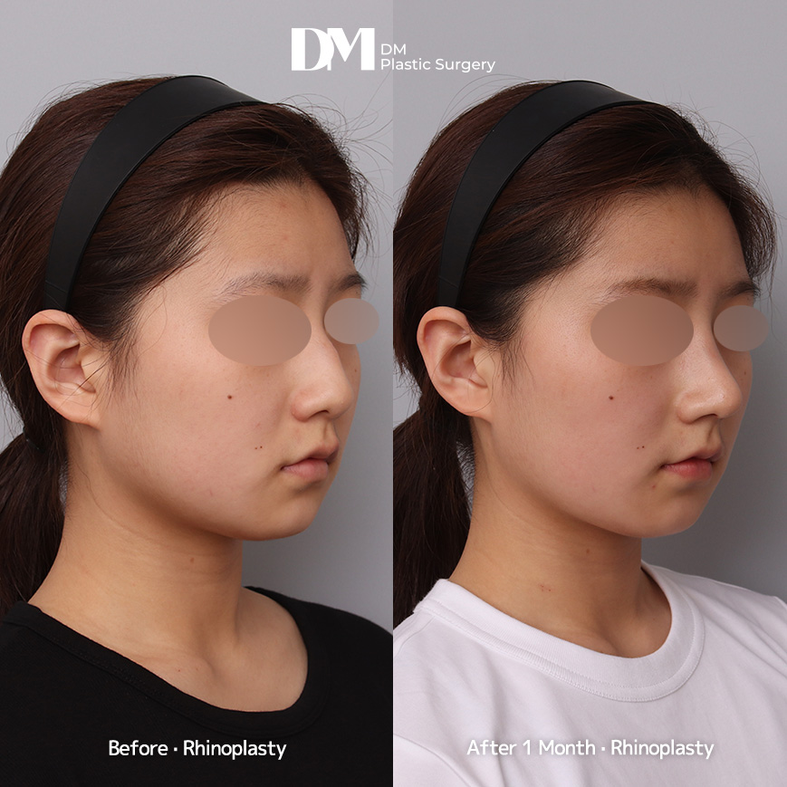 DM Cosmetic Surgery